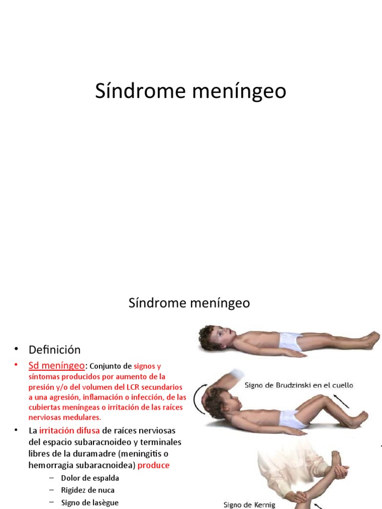 SD Meningeo | PDF | Meningitis | Epidemiología