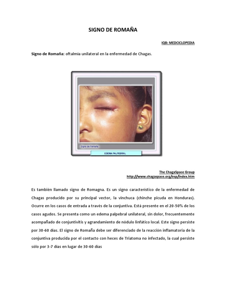 Signo de Romaña | PDF