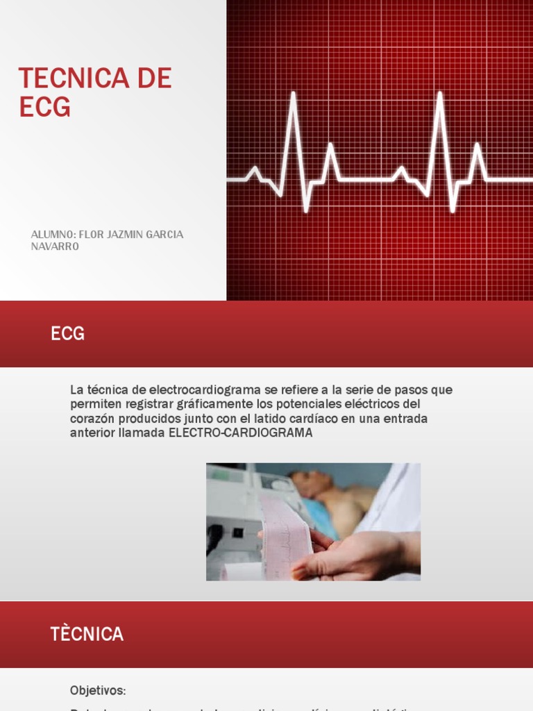Tecnica de Ecg | PDF | Electrocardiografia | Sistema cardiovascular
