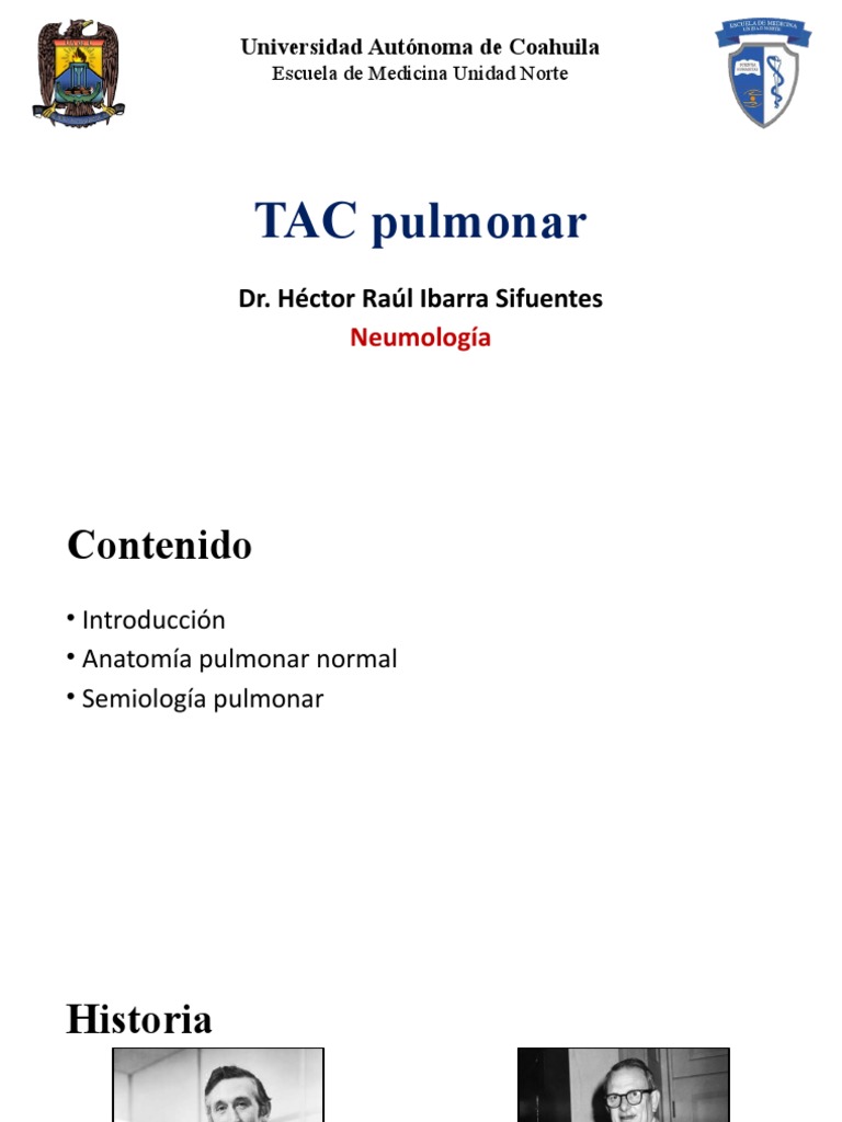 Interpretación del TAC Pulmonar | PDF | Ct Scan | Pulmón