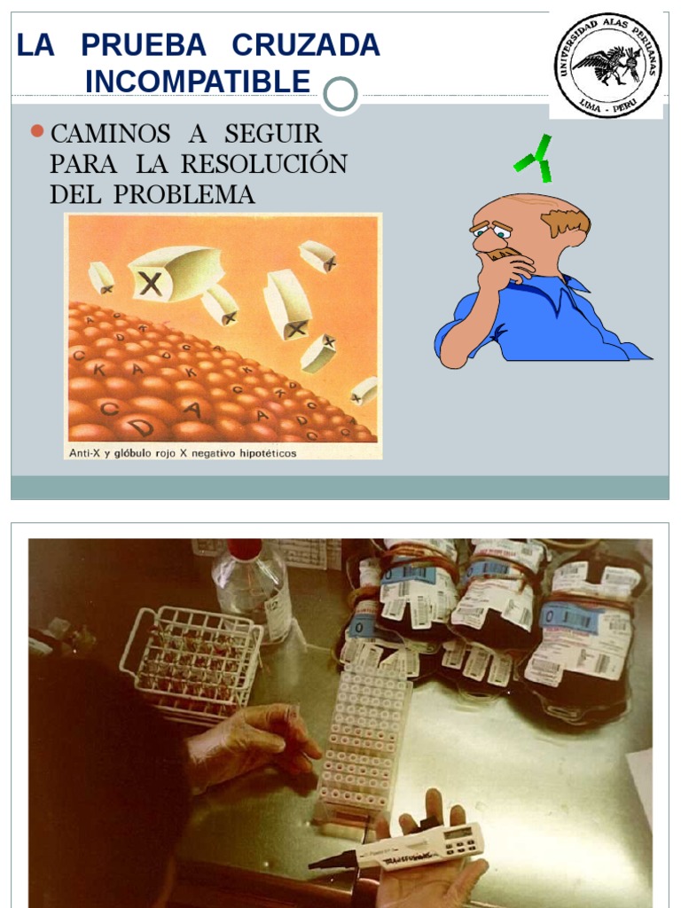 11-Prueba Cruzada Incompatible | PDF | Anticuerpo | Transfusión de sangre
