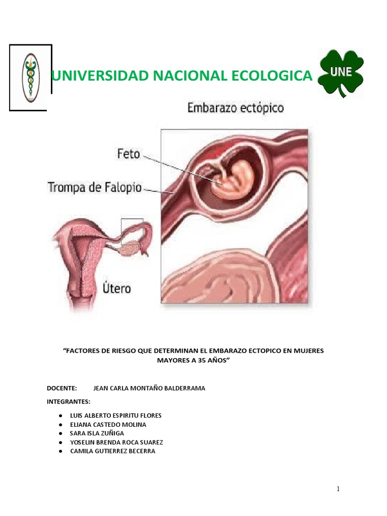 Embarazo Ectopico | PDF | El embarazo | Especialidades Medicas