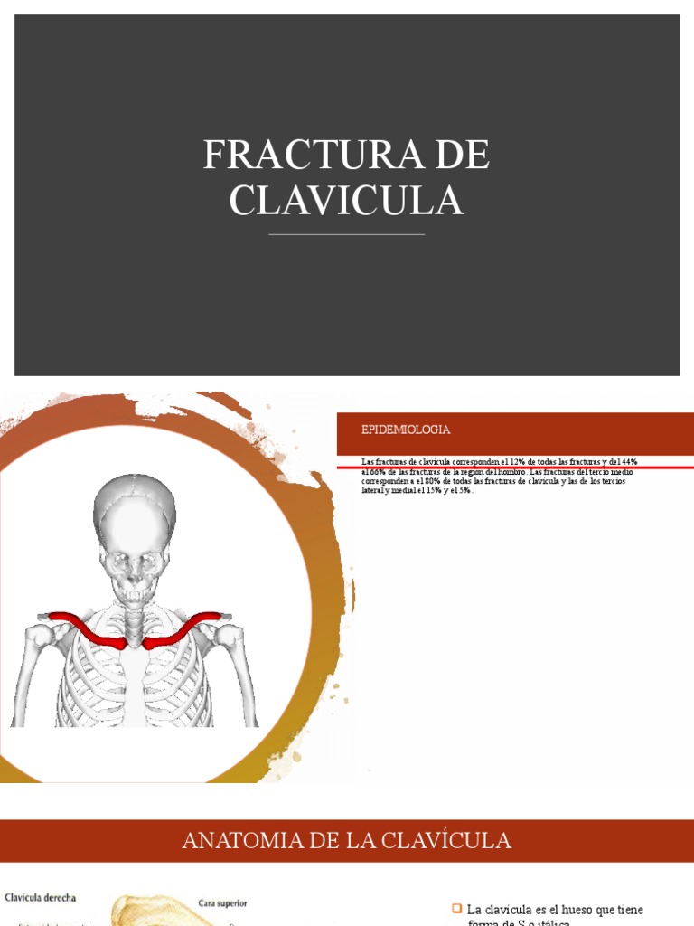 Fractura de Clavícula: Epidemiología y Tratamiento | PDF | Hombro ...