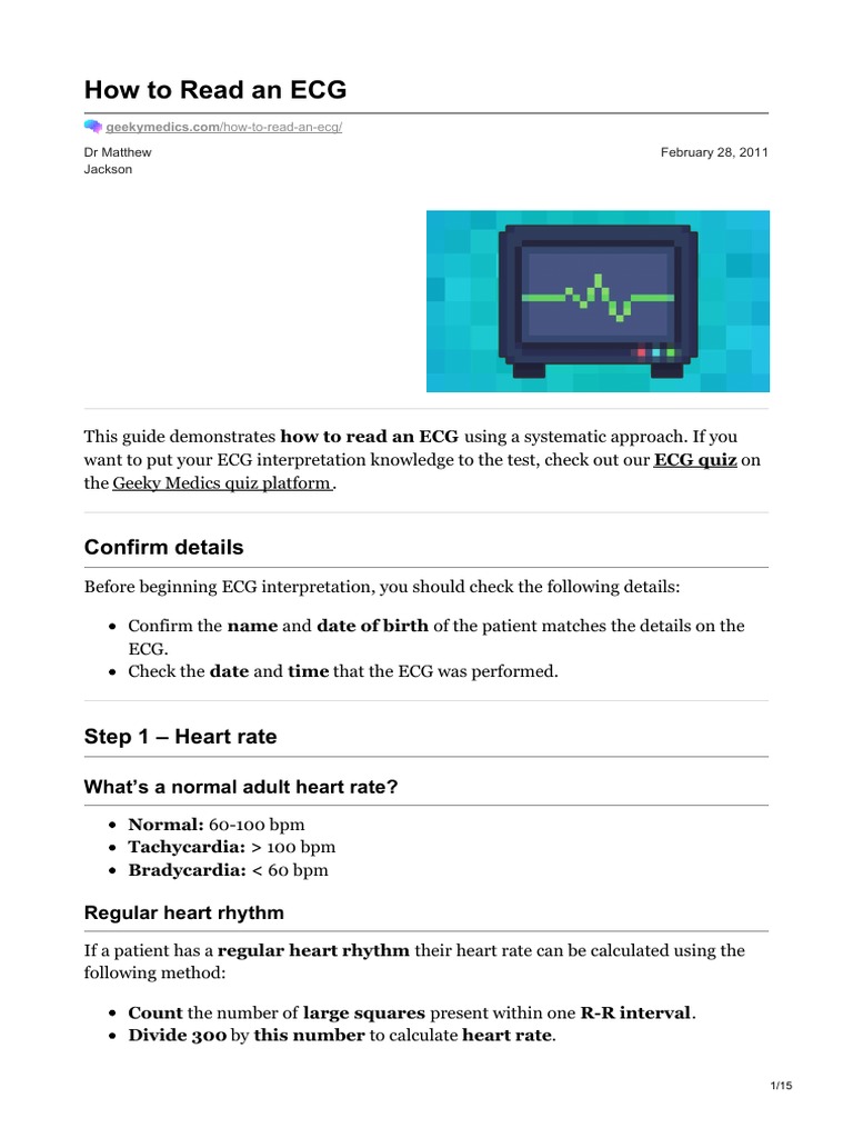 How To Read An ECG | PDF | Electrocardiography | Heart Rate