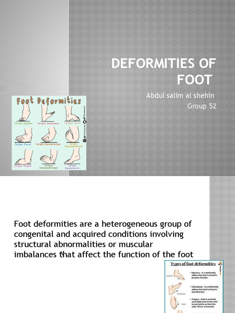 Deformities of Foot | PDF | Foot | Lower Limb Anatomy