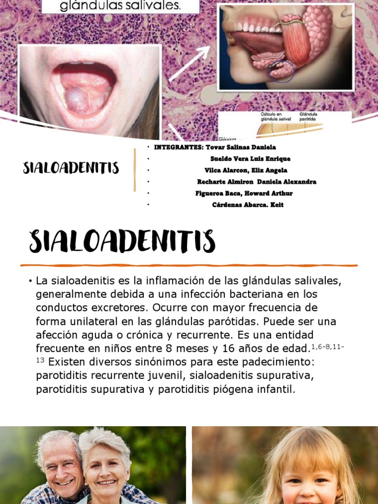 SIALOADENITIS | PDF | Ciencias de la Salud | Especialidades Medicas