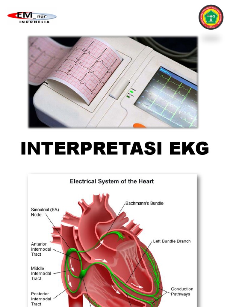 Ekg New 2022 | PDF
