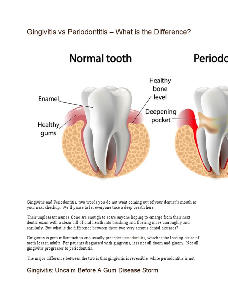 Gingivitis vs Periodontitis Explained | PDF | Dentistry Branches ...