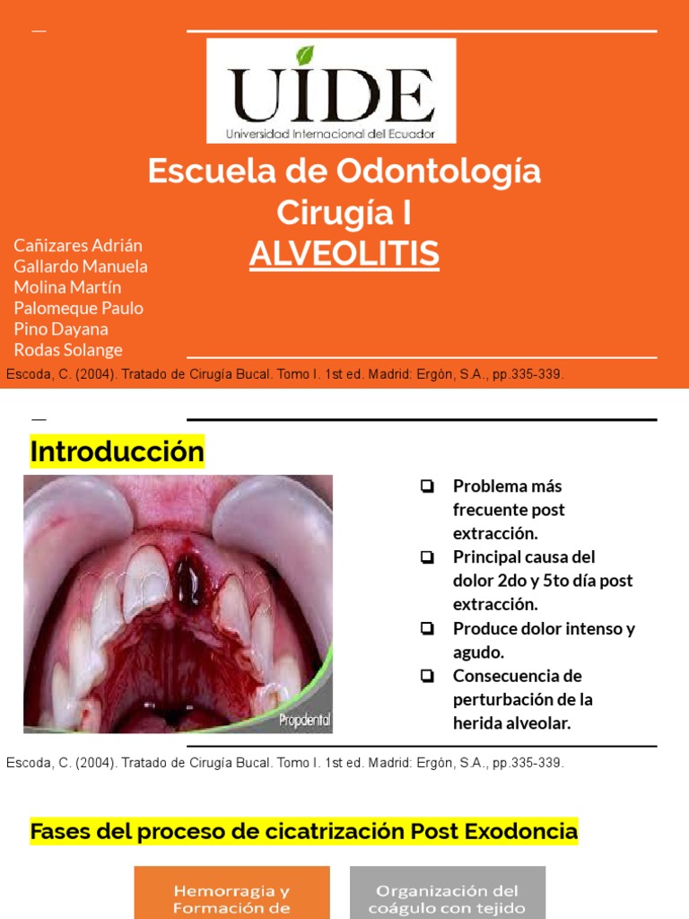 Proceso de cicatrización alveolar tras la extracción dental y factores asociados a la alveolitis ...
