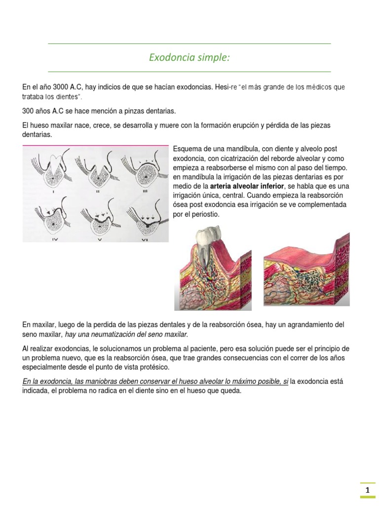 Exodoncia Simple | PDF | Ortodoncia | Diente