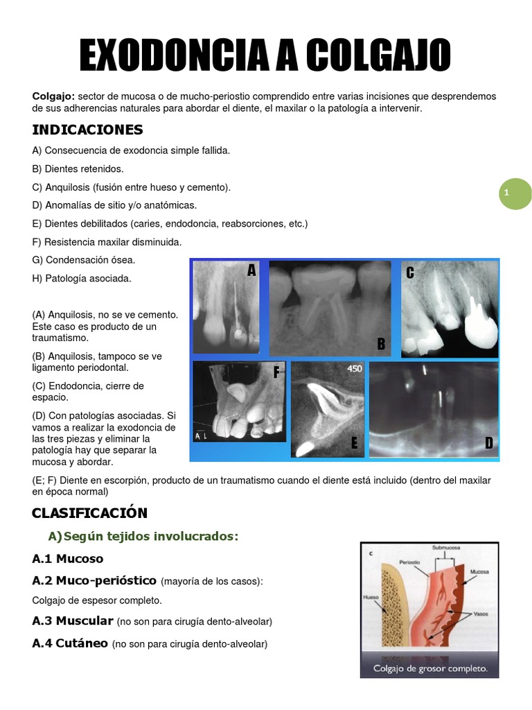 Exodoncia A Colgajo | PDF | Hueso | Diente