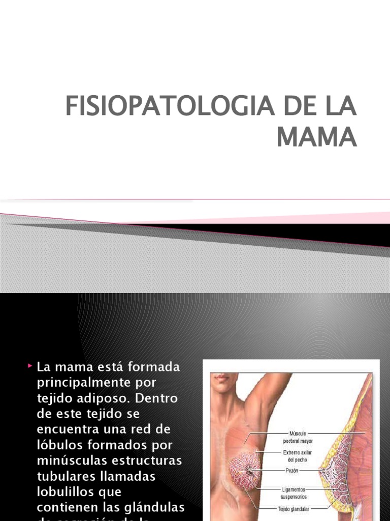 Fisiopatologia de La Mama | PDF | Cáncer de mama | Metástasis
