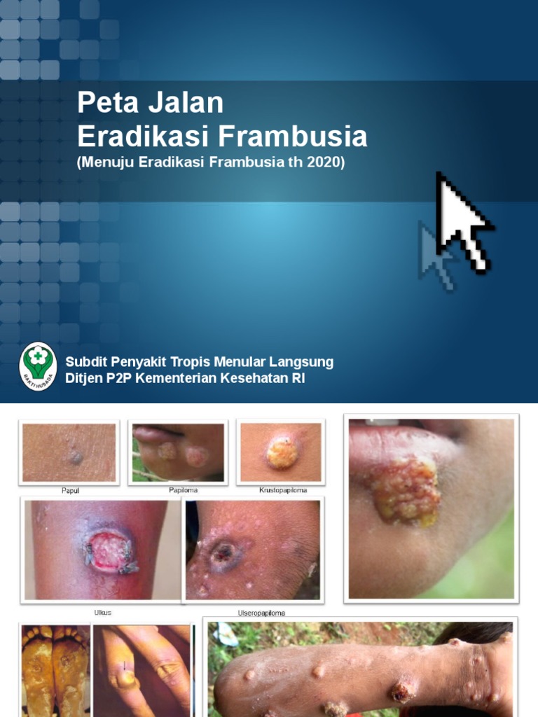 Peta Jalan Eradikasi Frambusia 2020 | PDF