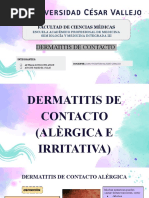 Tratamiento Dermatitis Atópica GPC | PDF | Alergia | Inmunología