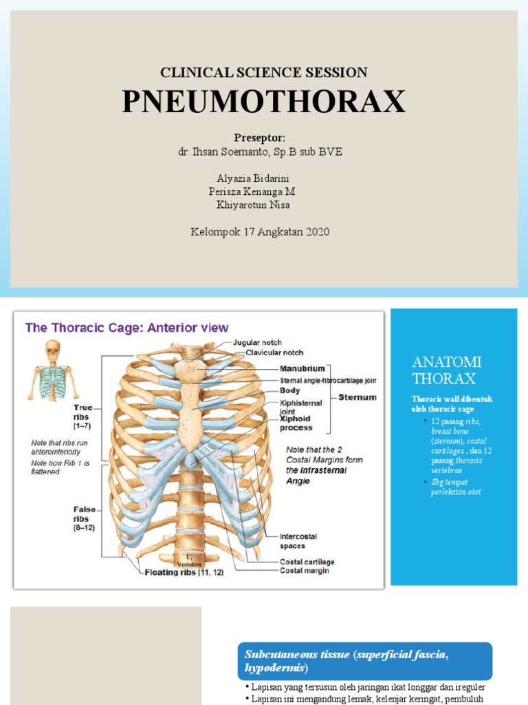 Pneumotoraks: Patofisiologi, Manifestasi Klinis, Diagnosis, dan ...