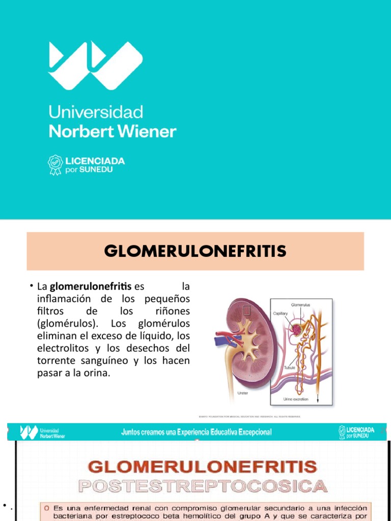 GLOMERULONEFRITIS | PDF
