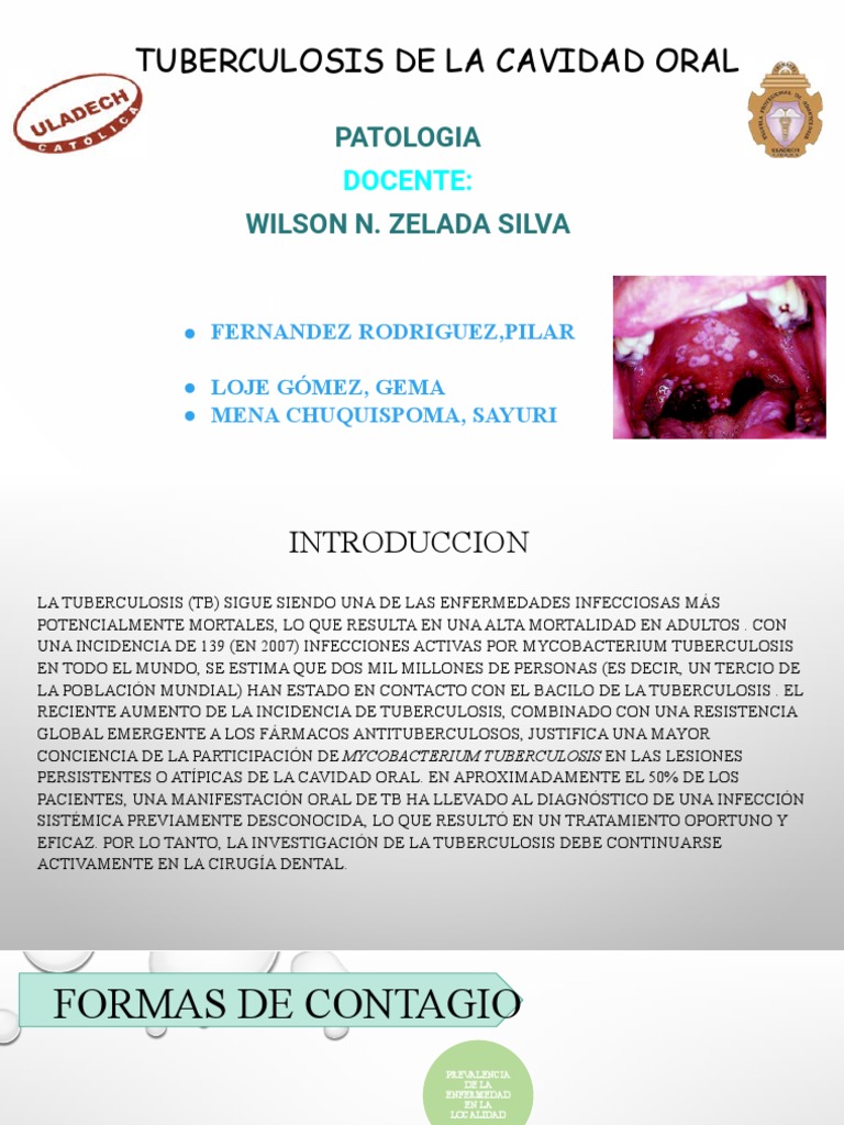 Tuberculosis en la cavidad oral | PDF | Tuberculosis | Epidemiología