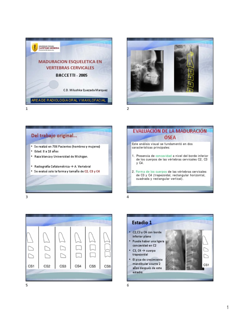 Método BACCETTI 2005 | PDF | Vértebra