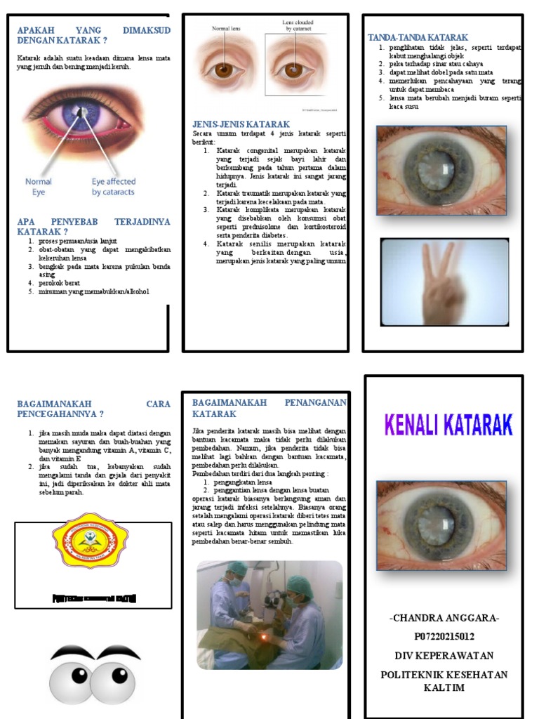 Leaflet Katarak | PDF