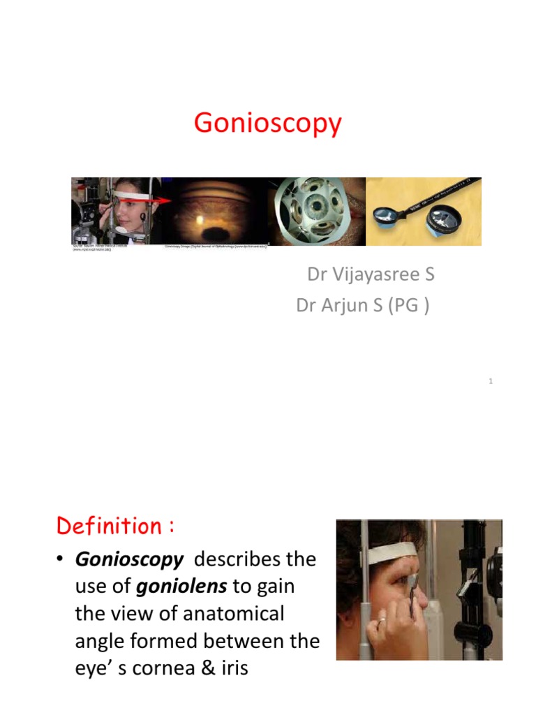 Gonio Arjun | PDF | Glaucoma | Cornea