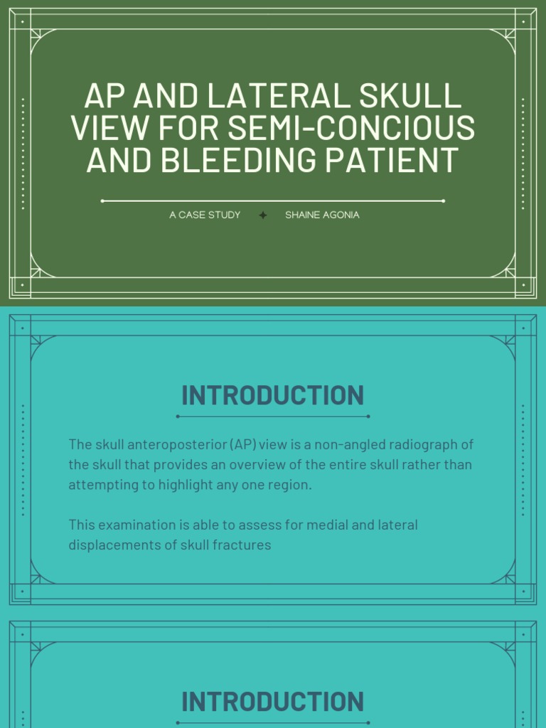 Ap and Lateral Skull View For Semi-Concious and Bleeding Patient | PDF