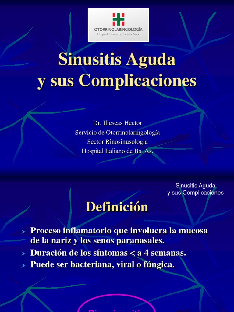 Sinusitis Aguda | PDF | Síntomas y signos | Especialidades Medicas