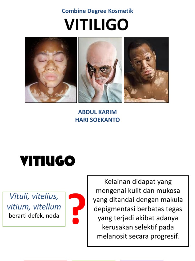 Combine Kosmetik Karim-Vitiligo-Print | PDF
