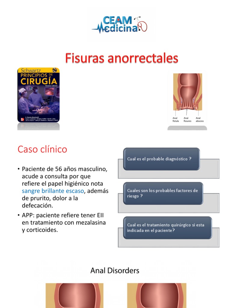 43 Fisura-Anorrectal | PDF | Heces | Hemorroides