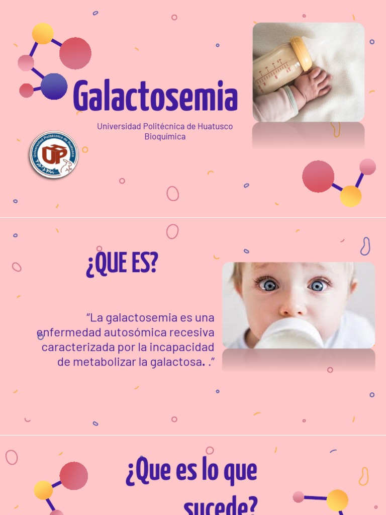 Galactosemia Clasica