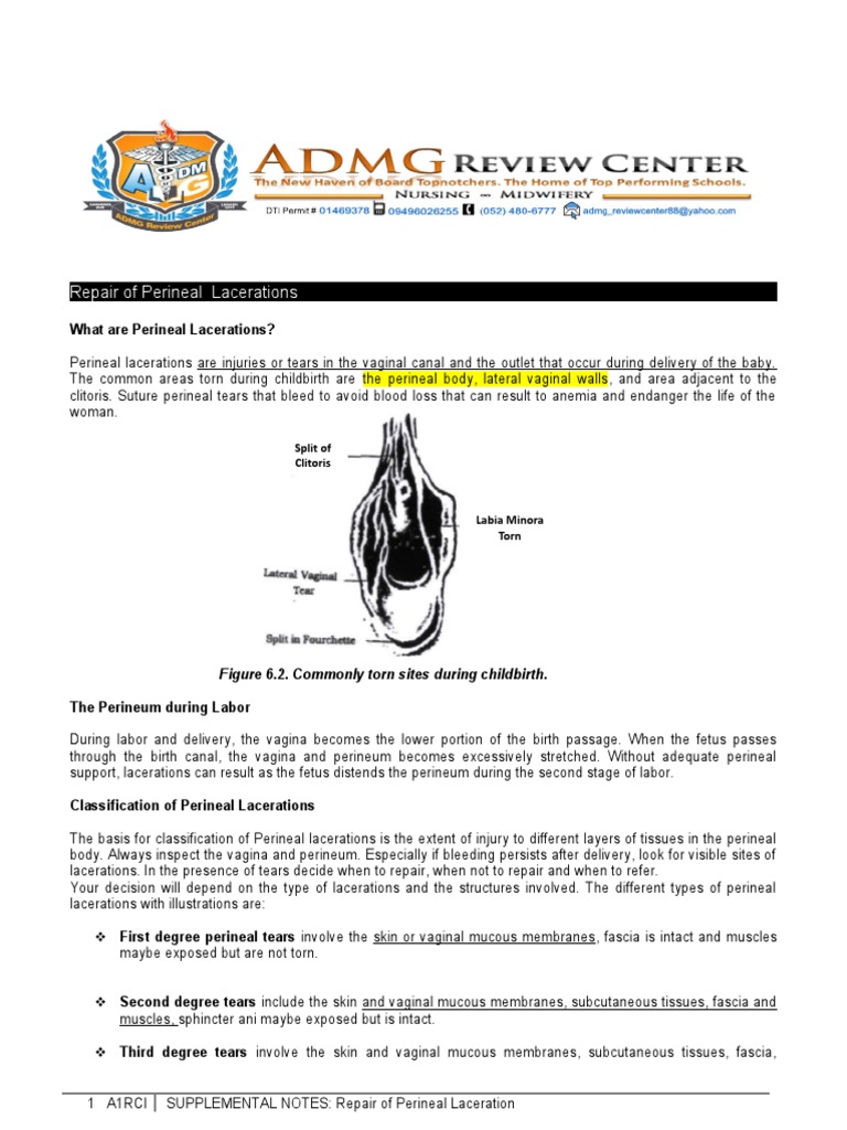 Perineal Laceration Repair Guidelines | PDF | Vagina | Surgical Suture