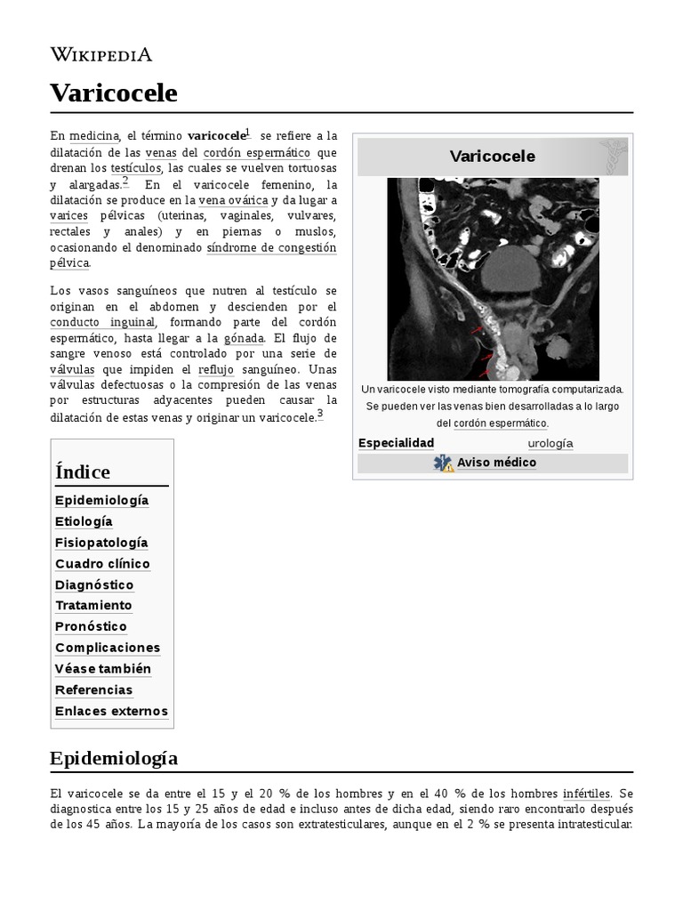Varicocele | PDF | Medicina CLINICA | Especialidades Medicas