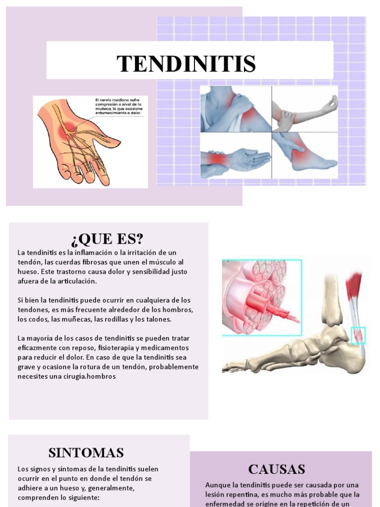 Signos y síntomas de la tendinitis | PDF | Hombro | Especialidades Medicas