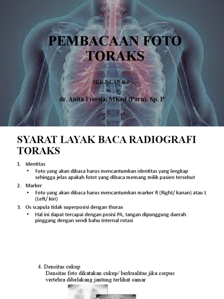 Pembacaan Foto Toraks | PDF