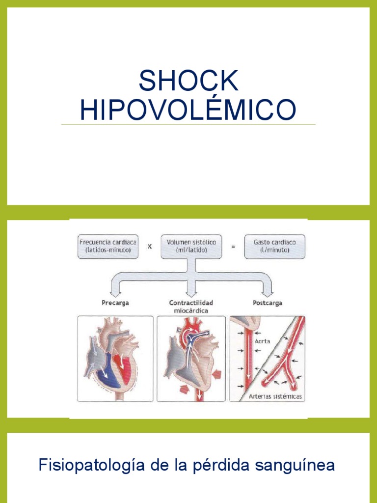 Shock Hipovolémico | PDF
