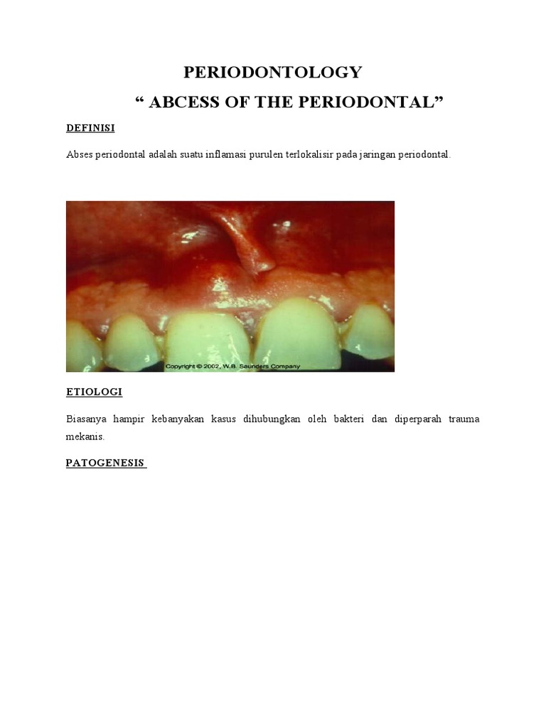 Abses Periodontal | PDF | Sains & Matematika