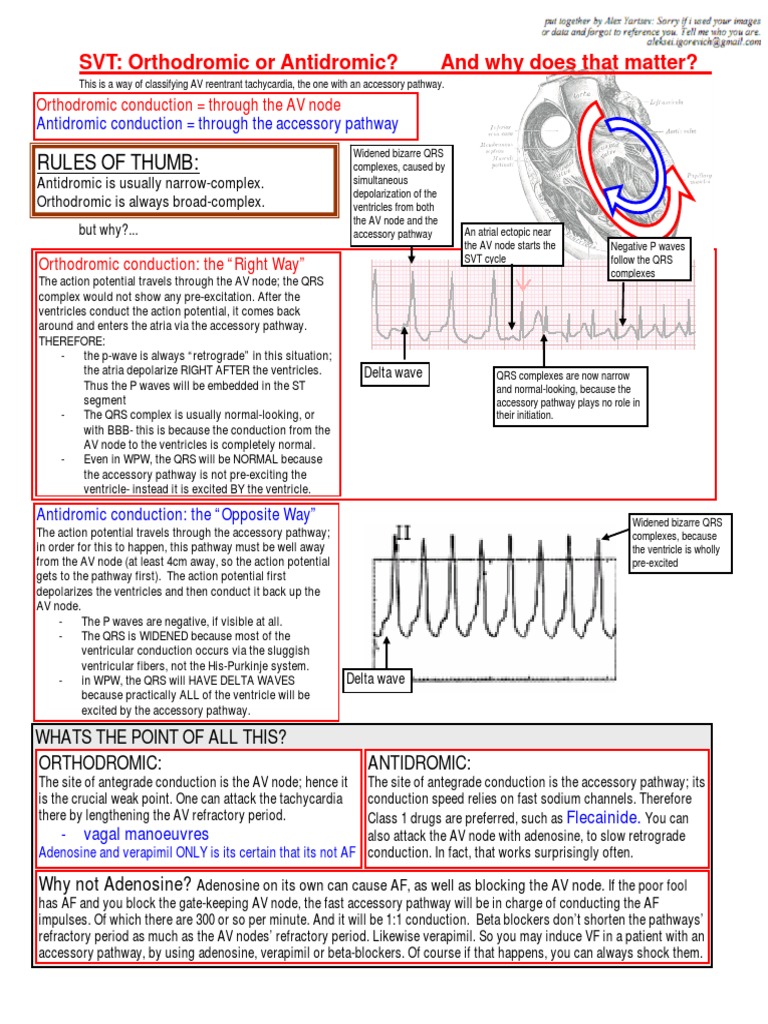 Orthdromic vs antidromic SVT, and why it matters | PDF | Clinical ...
