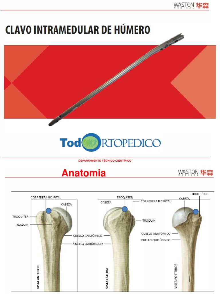 Guía de Cirugía de Fracturas Humerales | PDF | Hombro | Anatomía