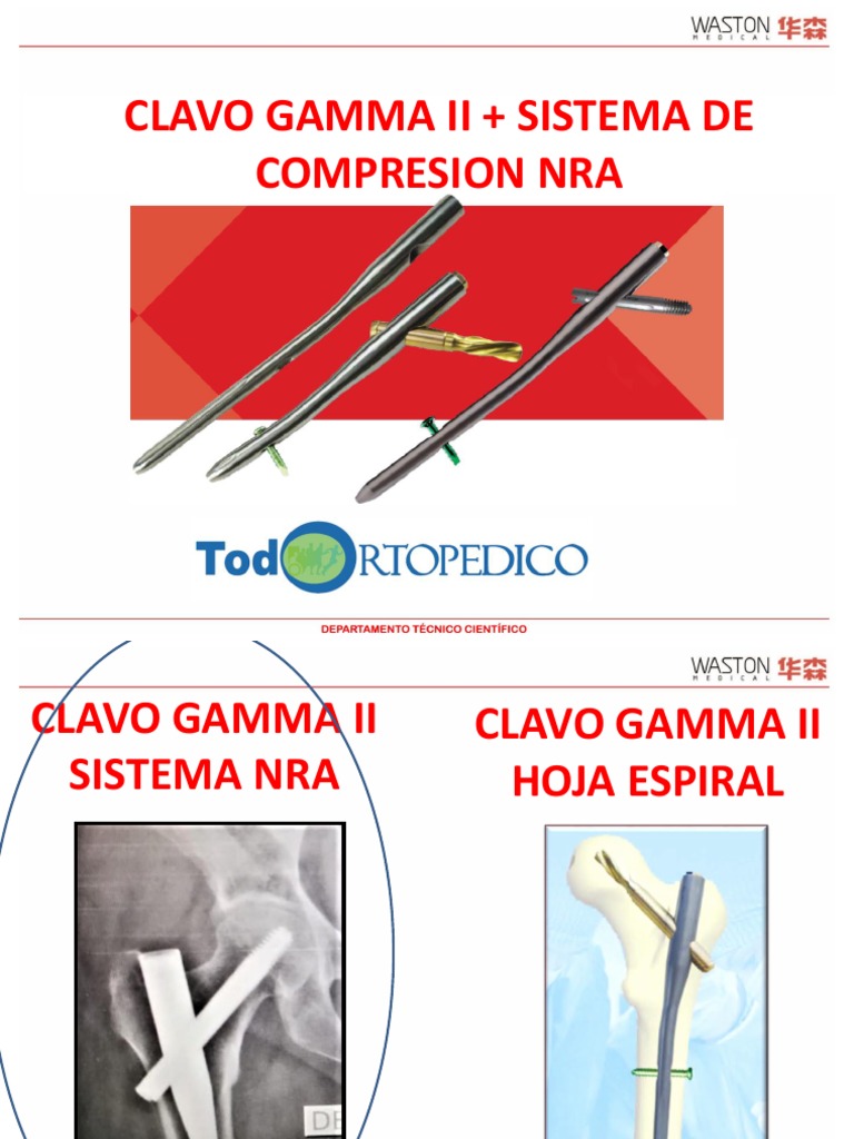 Clavo Gamma II y Sistema NRA | PDF | Tornillo