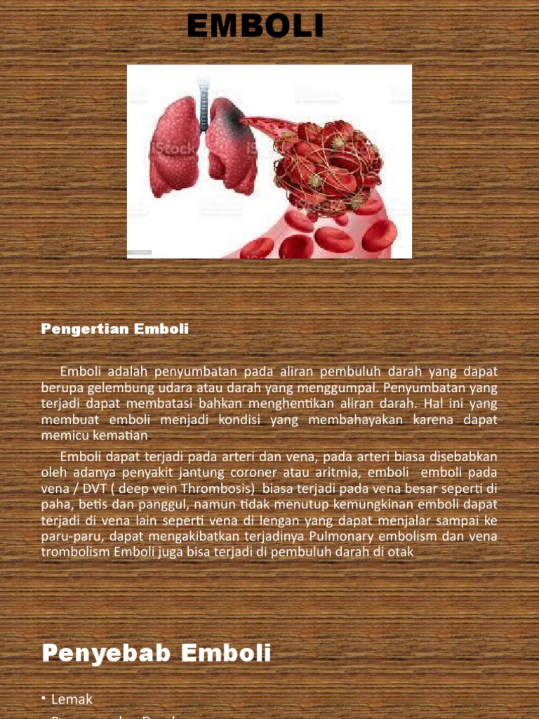 EMBOLI | PDF