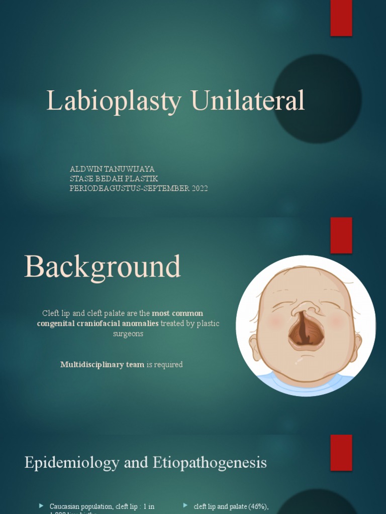 Labioplasty Unilateral - Aldwin Tanuwijaya | PDF | Medical Specialties ...