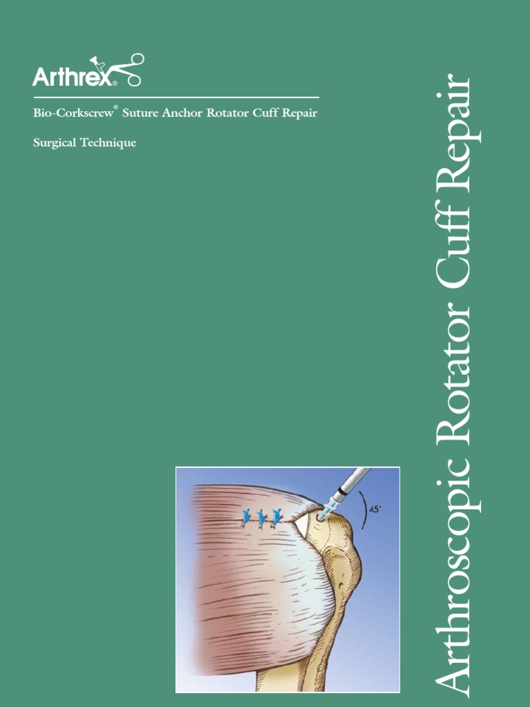 Arthrex BioCorkscrew | PDF | Surgical Suture | Anatomical Terms Of Location