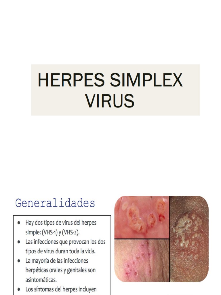 Herpes Simples 1 y 2 | PDF