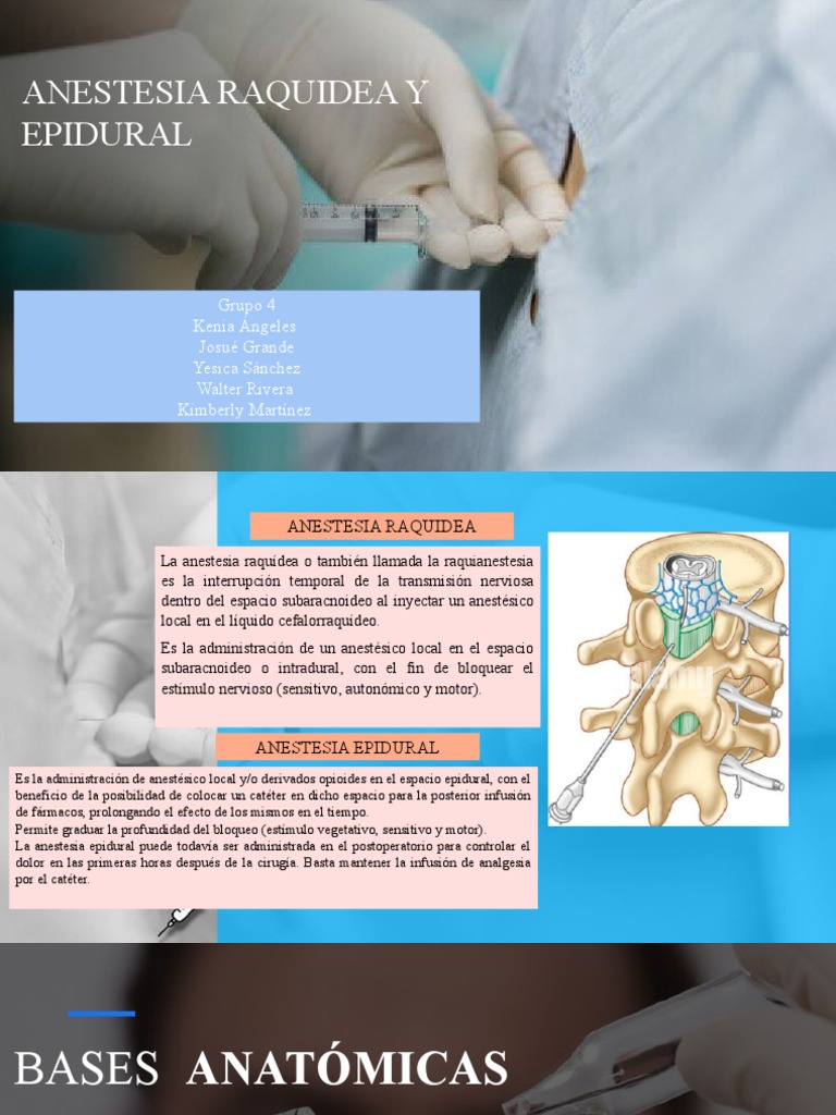 Anestesia Raquidea y Epidural | PDF | Sistema nervioso | Síntomas y signos