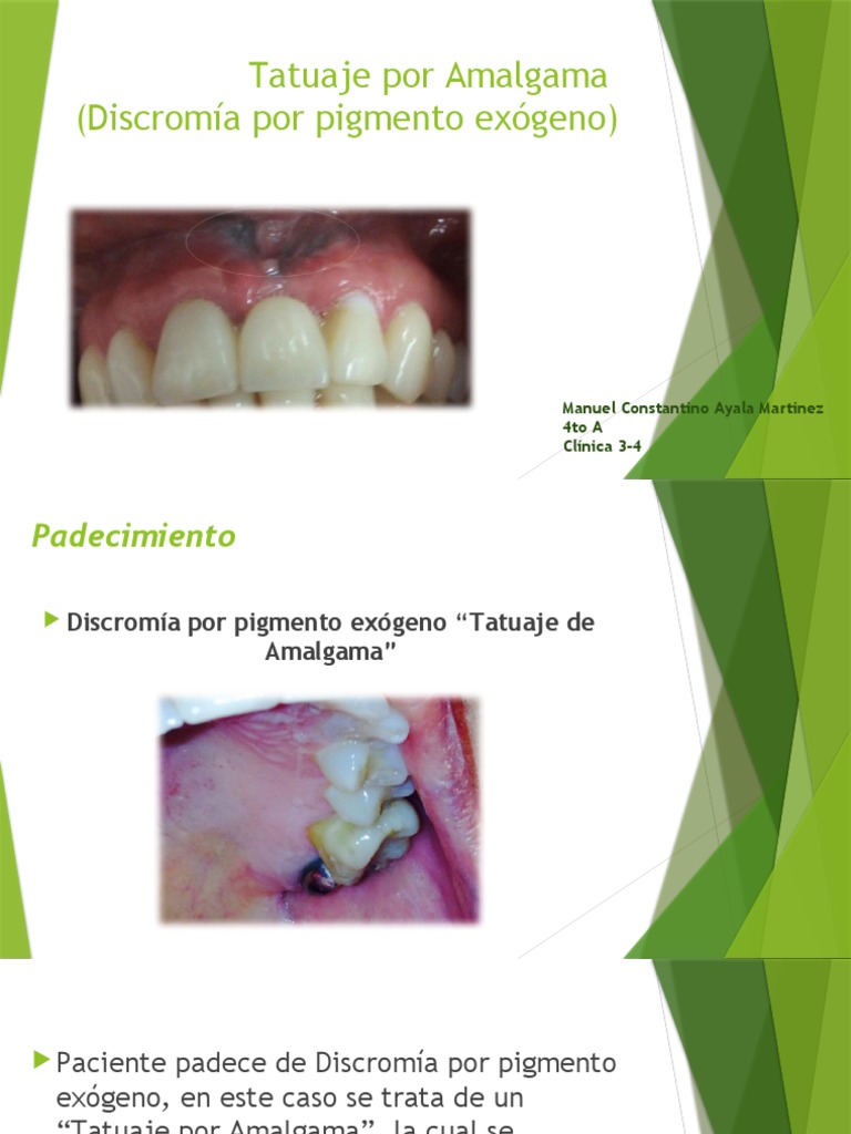 Tatuaje Por Amalgama | PDF | Enfermedades y trastornos | Anatomía