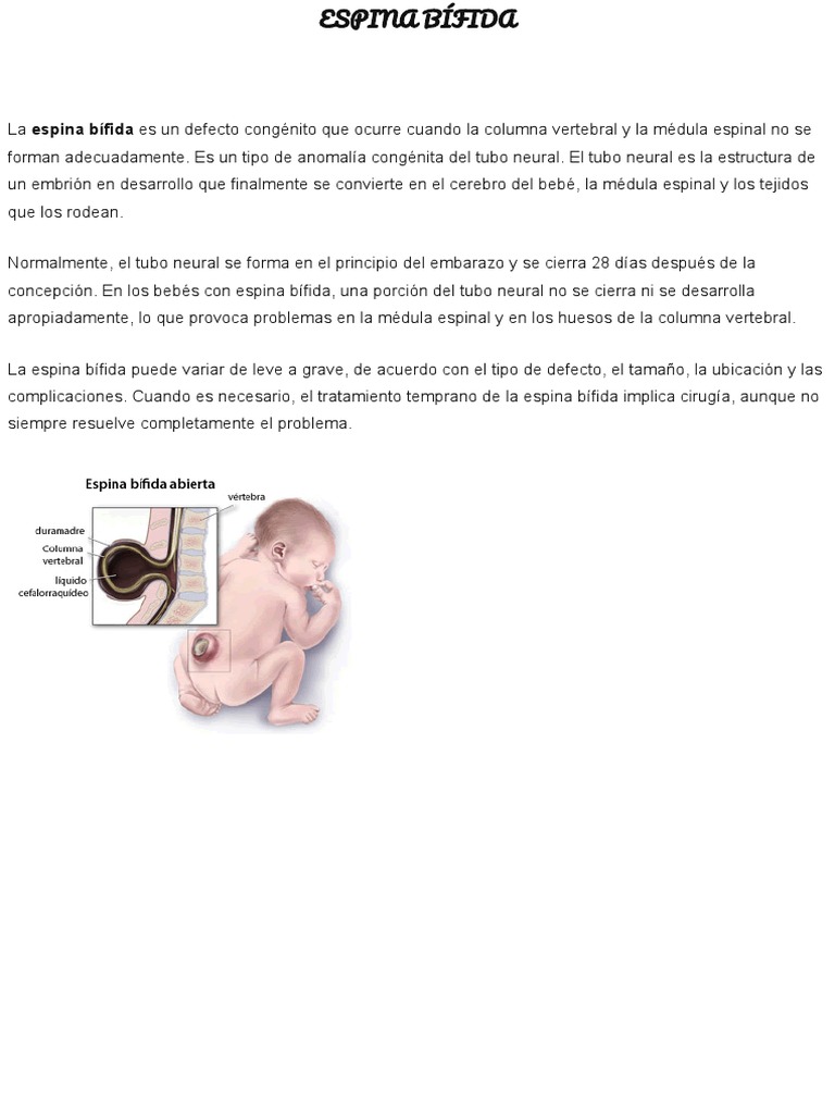 Espina Bífida | PDF | Medicina CLINICA | Especialidades Medicas