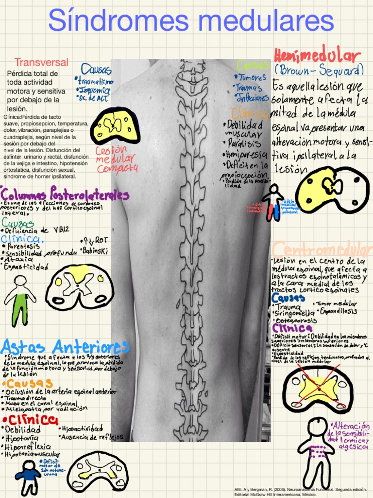 Síndromes Medulares | PDF