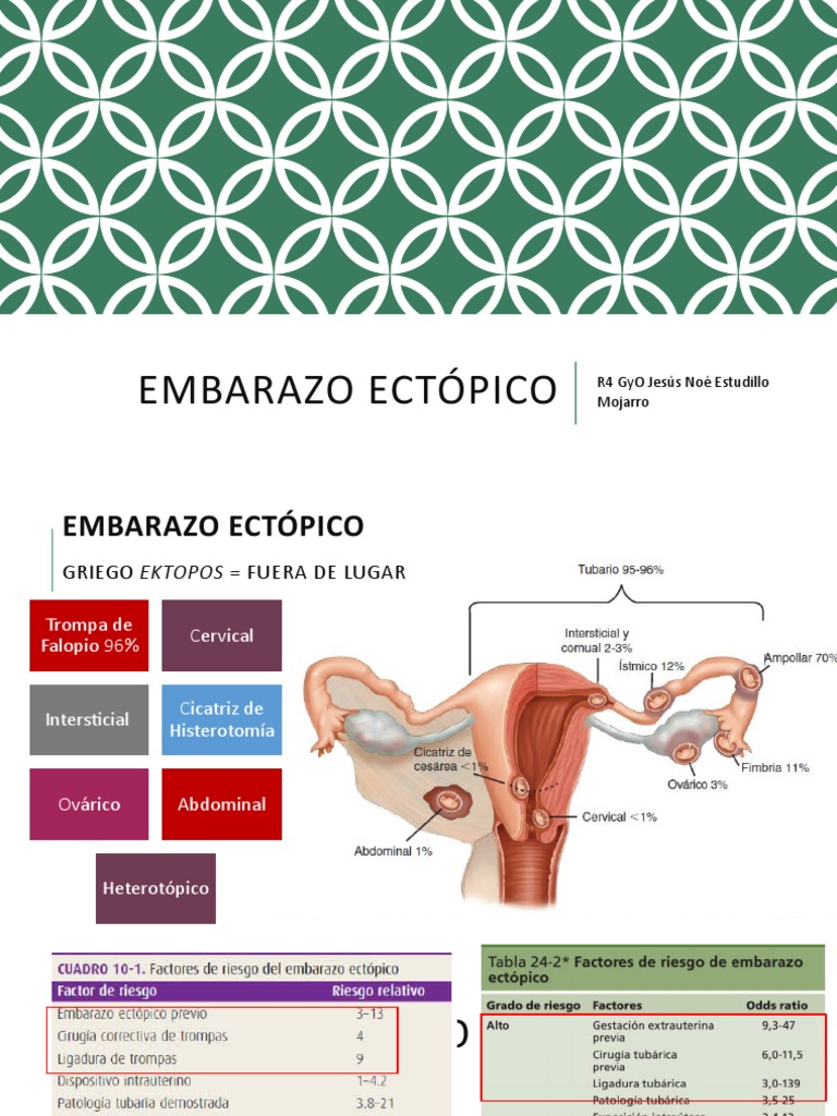 Embarazo Ectópico | PDF | El embarazo | Reproducción
