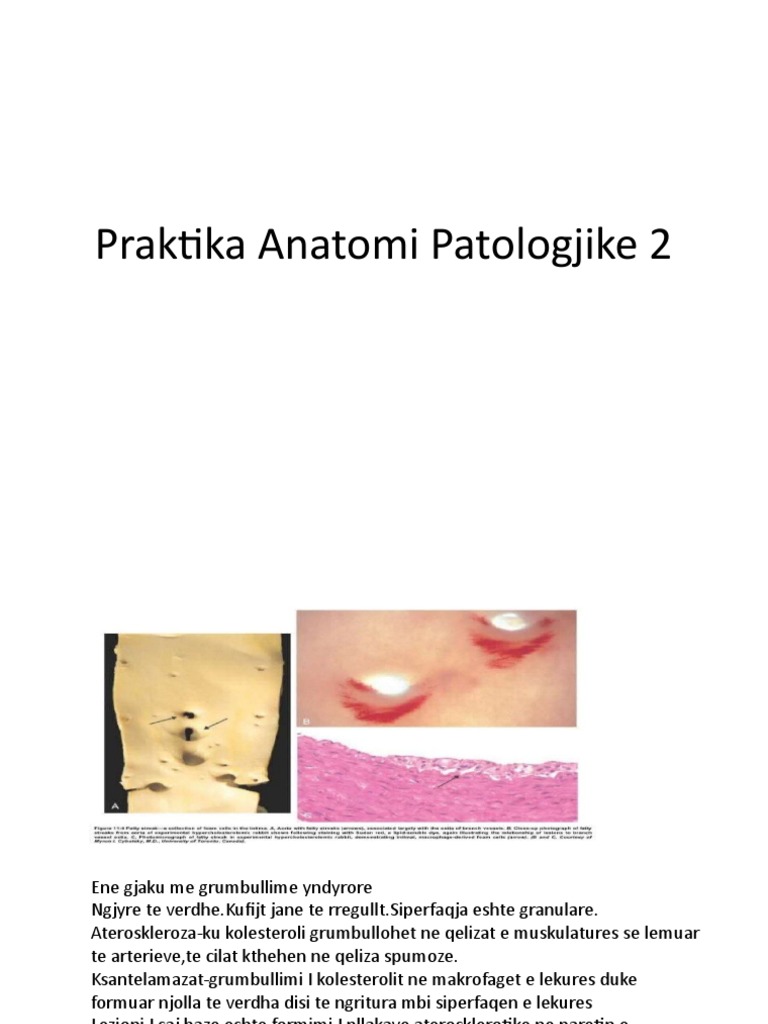 Praktika Anatomi Patologjike 2 | PDF