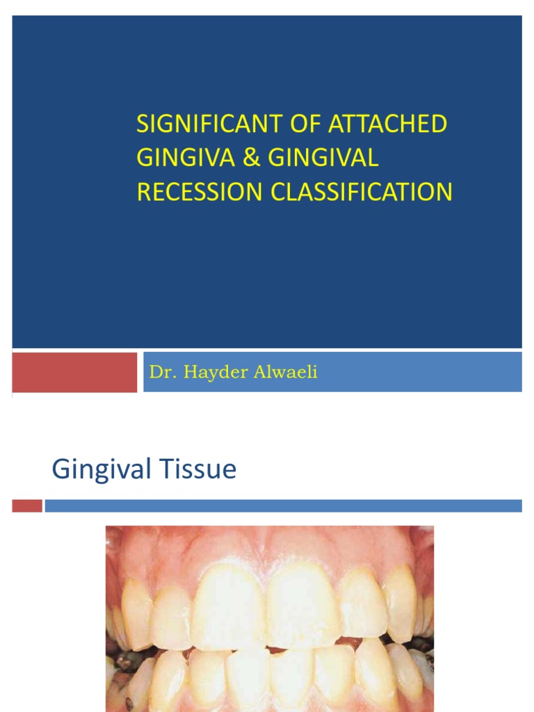 Significant of Attached Gingiva & Gingival Recession Classification | PDF