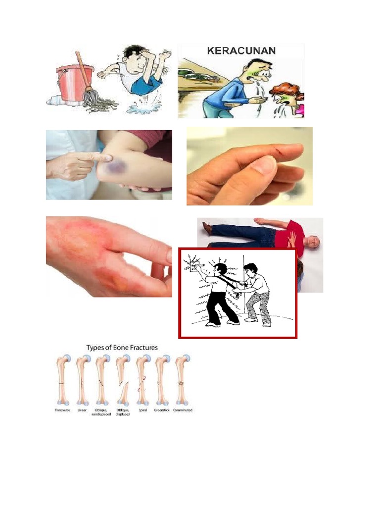 RAWATAN Kemalangan Di Bilik Masakan | PDF